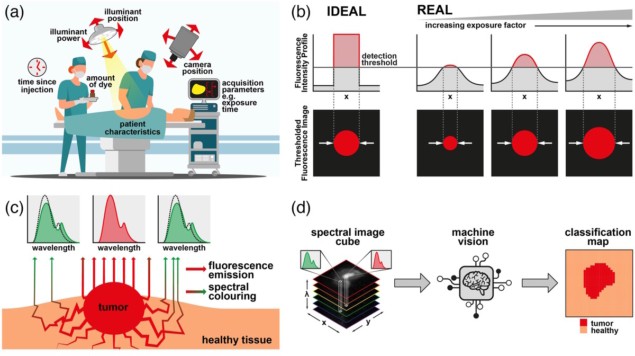 Multispectral infrared imaging improves guidance of cancer surgery ...