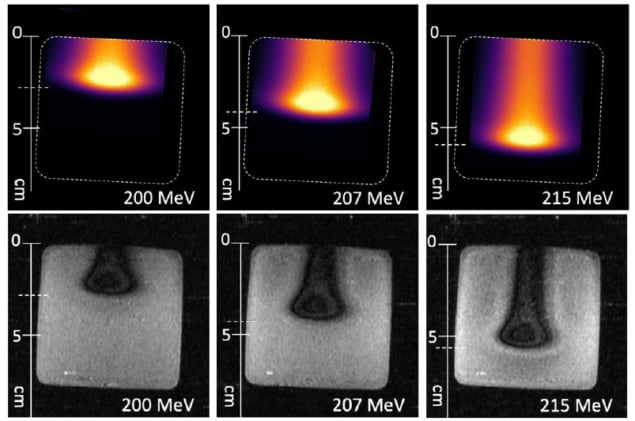 Patient-specific ridge filters enable conformal FLASH proton therapy ...