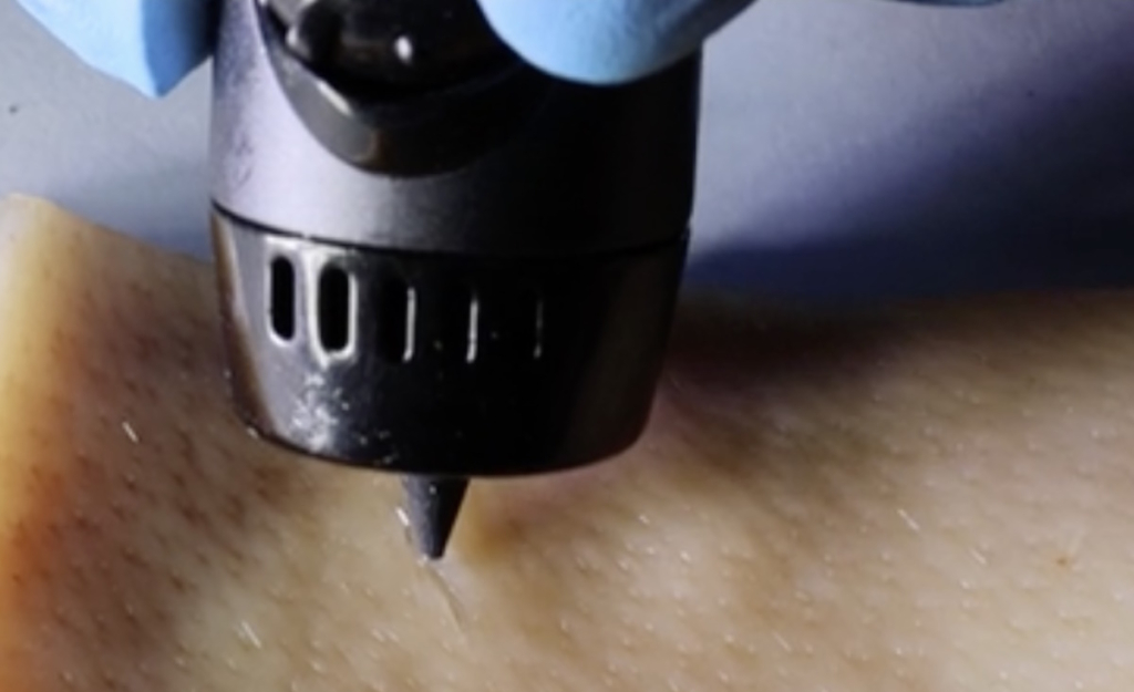 Paintable bioactive ink heals wounds of any shape or size – Physics World