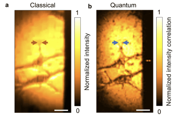 Quantum entanglement doubles microscope resolution – Physics World