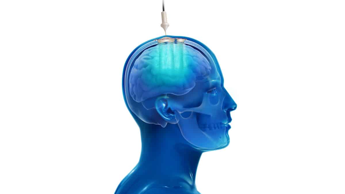Ultrasound implant helps deliver powerful chemotherapy to brain tumours ...