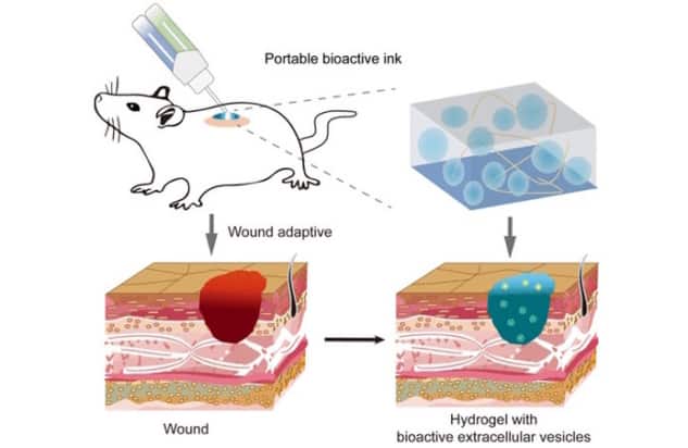 Paintable bioactive ink heals wounds of any shape or size – Physics World