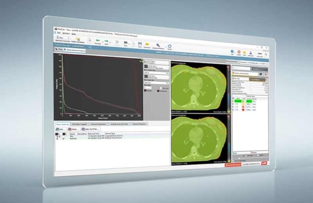 Automated patient QA using RadCalc software for helical tomotherapy ...