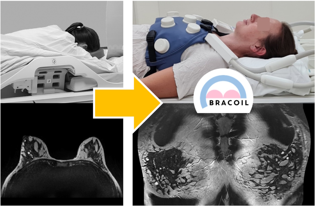 Wearable coil vest could change the game in breast MRI – Physics World