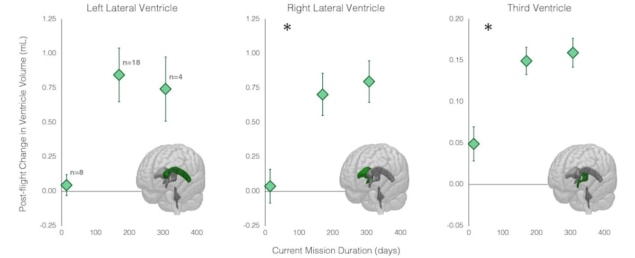 Life in space impacts human brain structure – Physics World