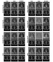 Can state-of-the-art linacs boost the uptake of 4D-CBCT in radiotherapy ...