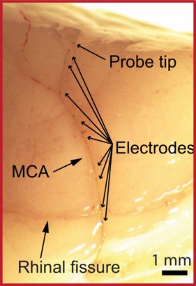 Tiny probe measures deep-brain activity from inside a blood vessel ...