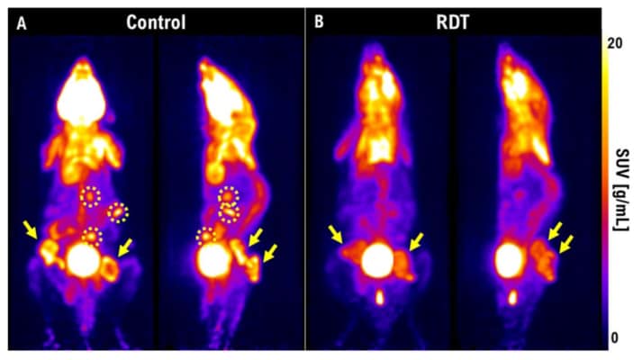 Radiodynamic therapy: harnessing light to improve cancer treatments ...