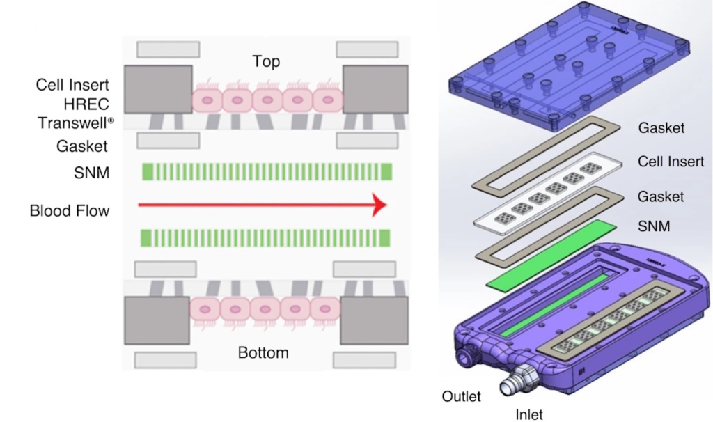 Implantable bioartificial kidney aims to free patients from dialysis ...
