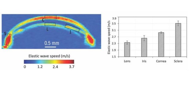 Multi-eye-component imaging could help diagnose ocular disease ...