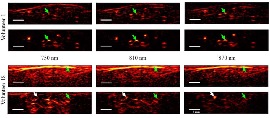 High-quality diagnostic imaging – for all skin tones – Physics World