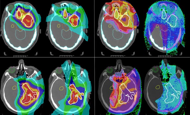 Medical physics Archives – Physics World