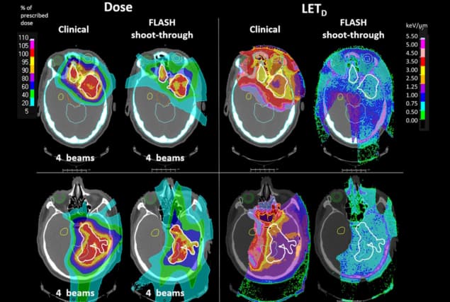 Shoot-through proton FLASH: a robust approach to brain tumour treatment ...
