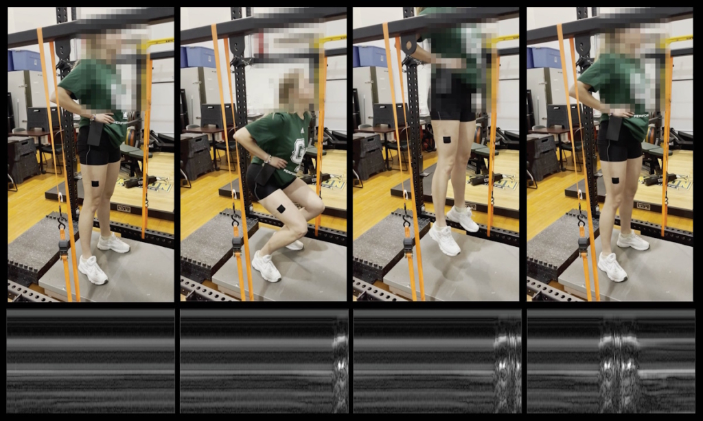 Ultrasound innovations enable pain-free vaccination, monitor muscle ...