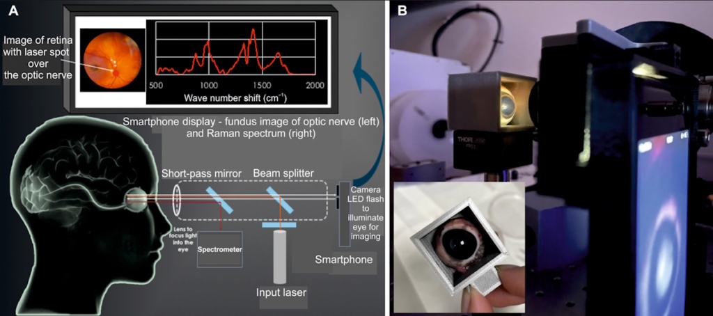 Handheld device uses eye-safe retinal spectroscopy to diagnose brain ...
