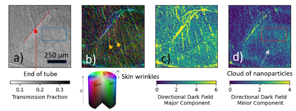 Dark-field X-ray imaging reveals potential of nanoparticle-delivered gene therapy – Physics World