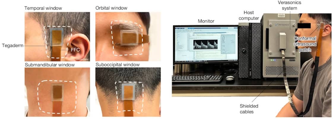 Ultrasound patch continuously tracks blood flow in the brain – Physics ...