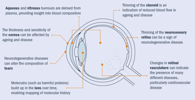 Oculomics: a window to the health of the body – Physics World