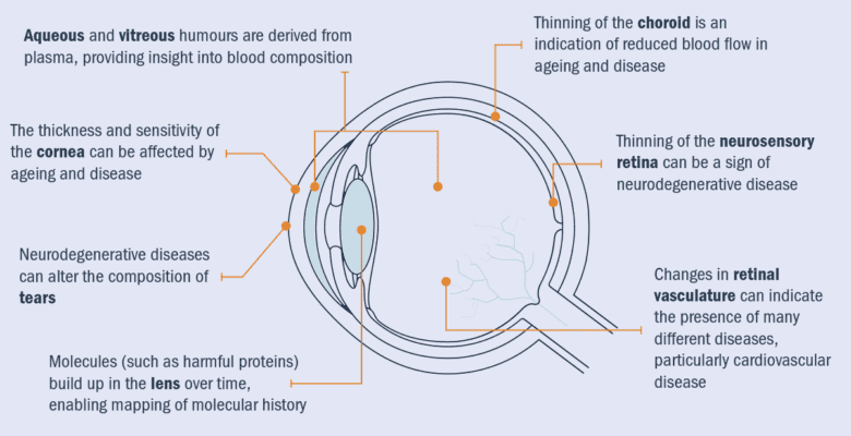 Oculomics: a window to the health of the body – Physics World