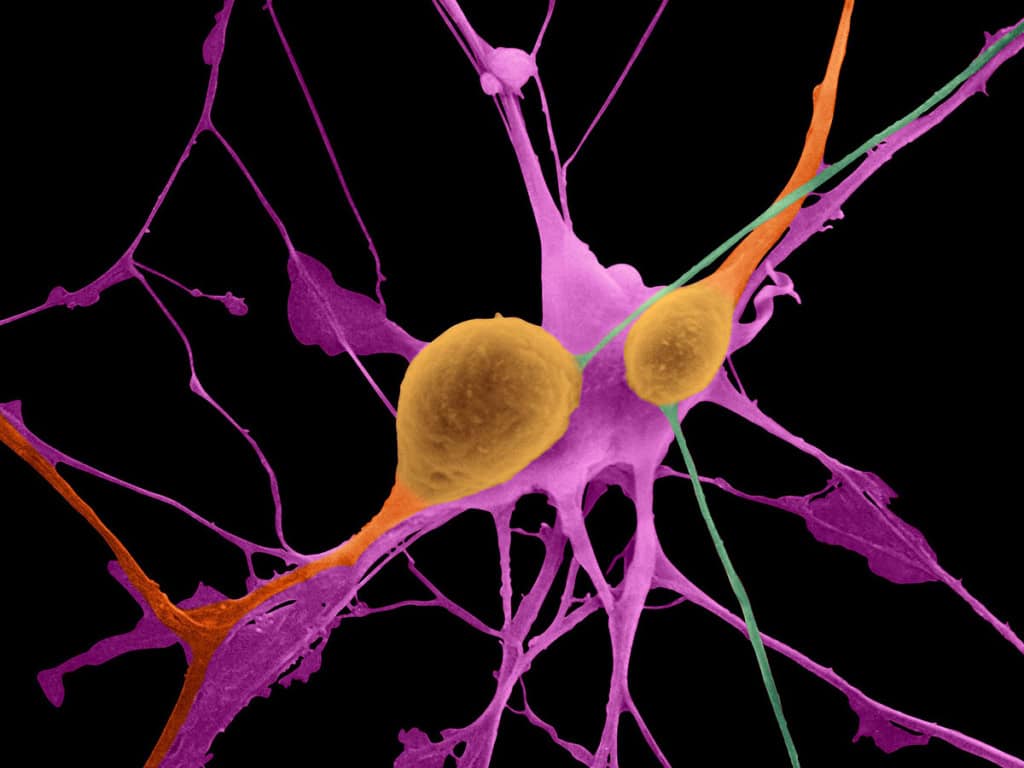 Physics for excited neurons – Physics World