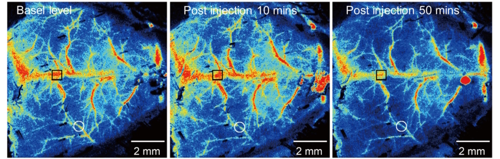 Imaging reveals how microplastics may harm the brain – Physics World