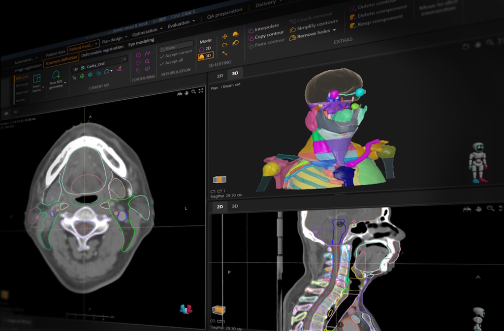 Fast and predictable: RayStation meets the needs of online adaptive ...