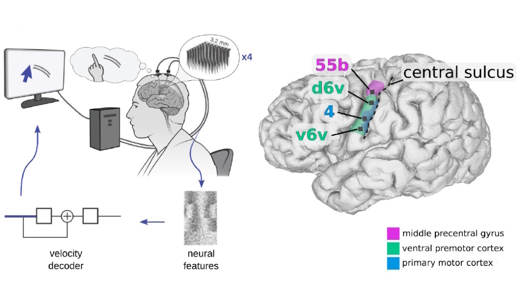 Tiny sensor creates a stable, wearable brain–computer interface ...