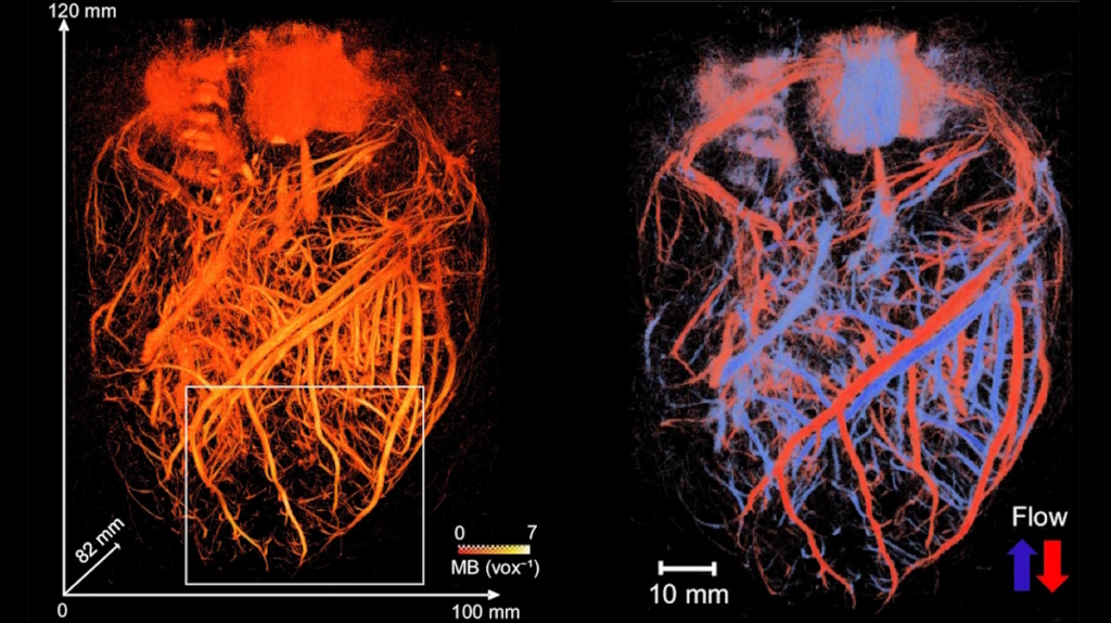 Medical physics Archives – Physics World