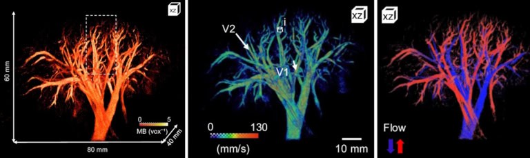 Ultrasound probe maps real-time blood flow across entire organs ...